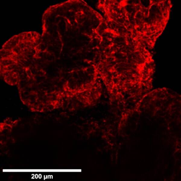 High resolution imaging of 3D organoids at low magnification - CrestOptics