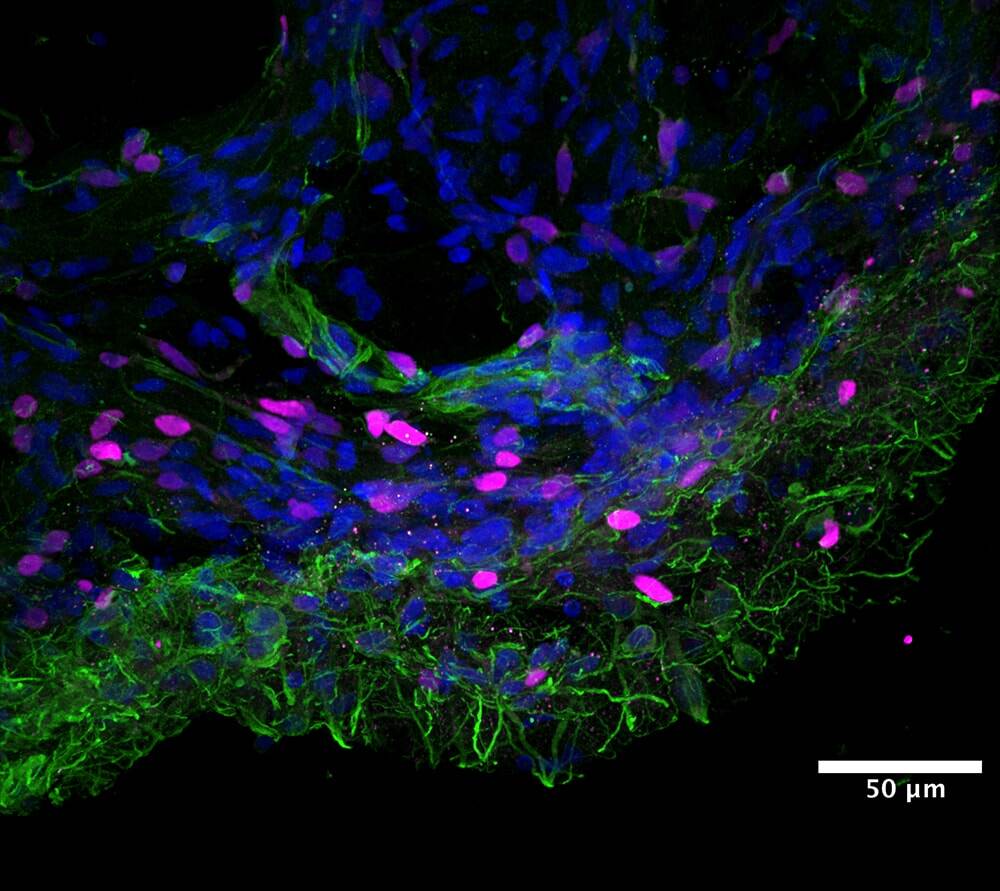 Brain organoid: visualization of cortical neuron subtypes - CrestOptics