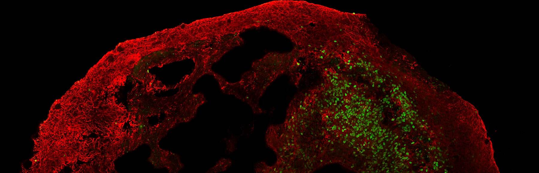 Brain organoid: visualization of cortical neuron subtypes - CrestOptics