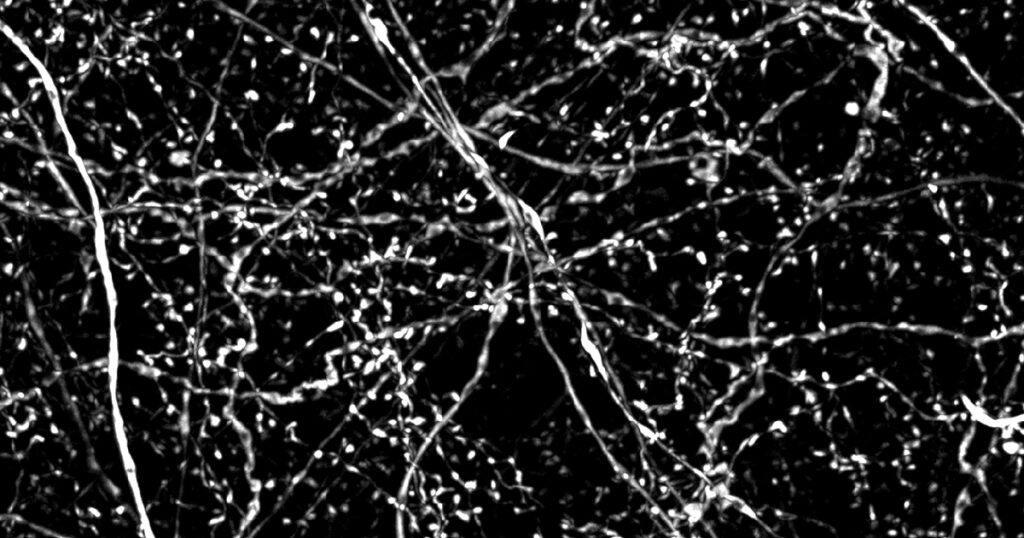 DeepSIM of neurobiological samples - CrestOptics