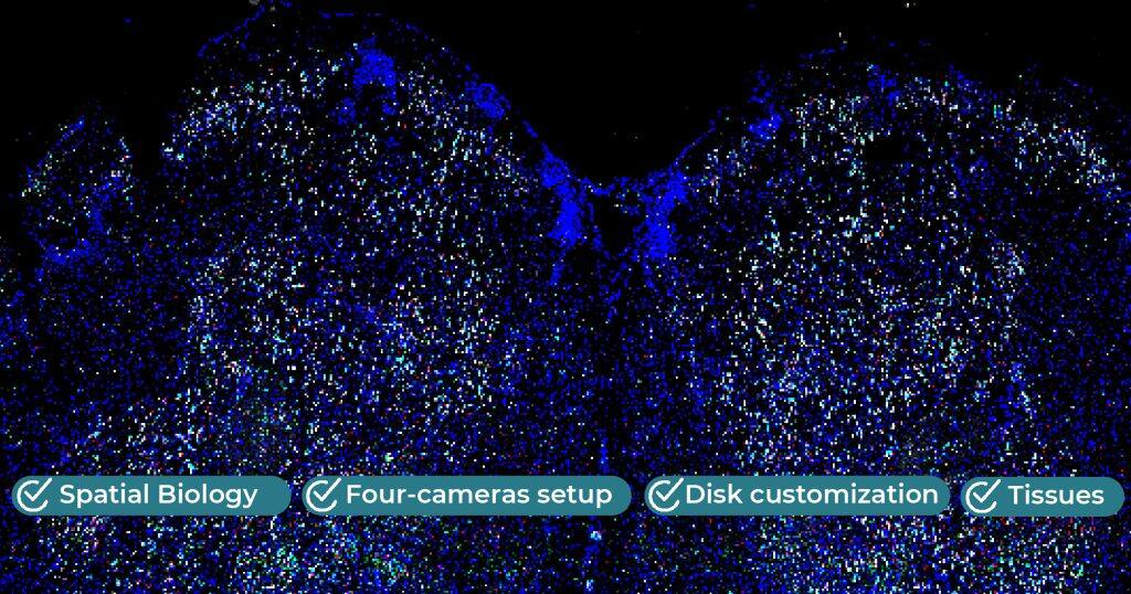 New confocal solutions for 3D spatial transcriptomics - CrestOptics