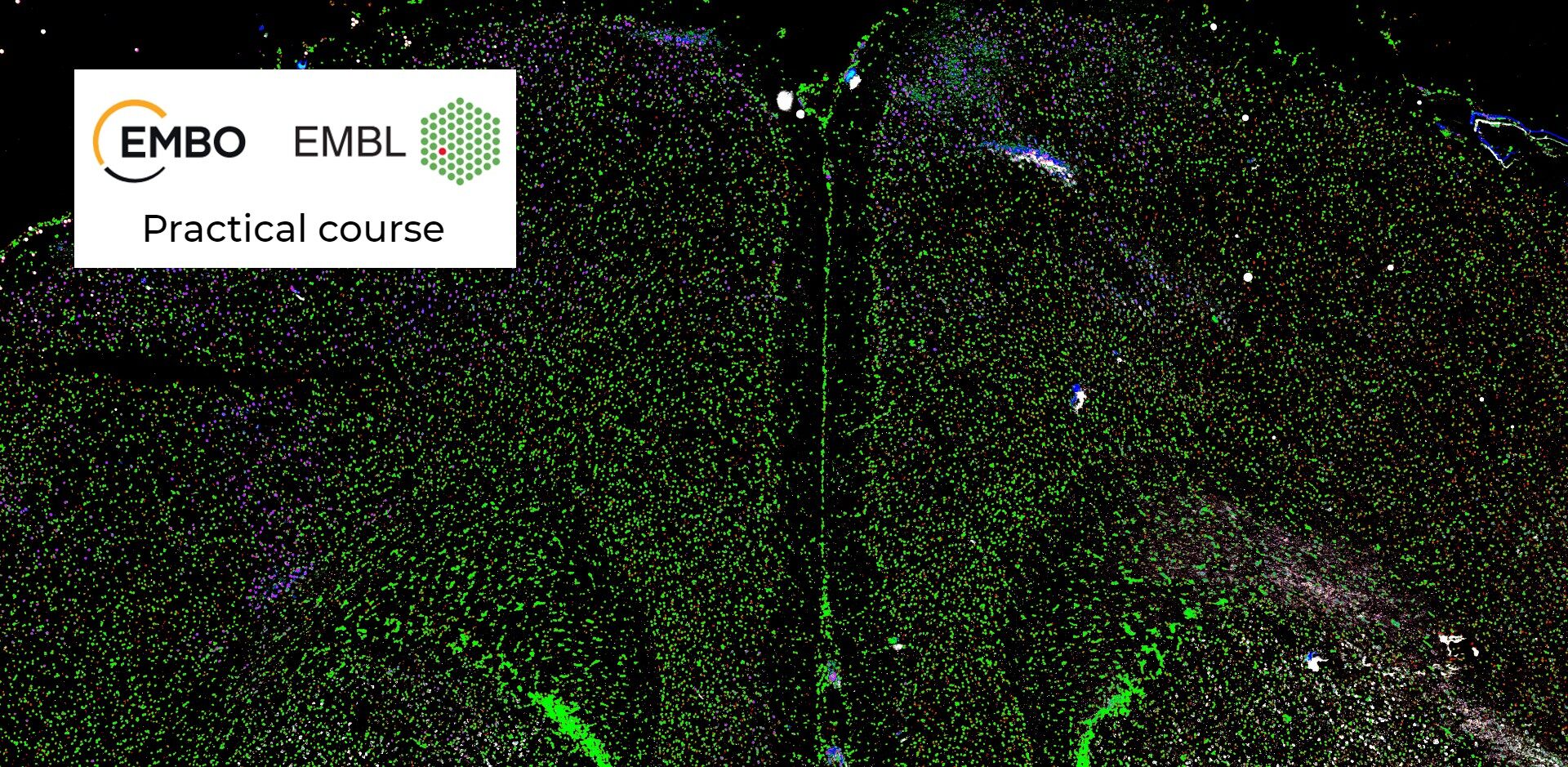 EMBO Practical Course @ EMBL Rome - CrestOptics